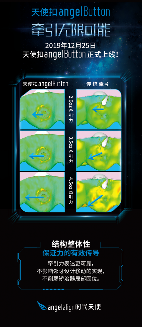 时代天使天使扣angelButton正式上线，全新牵引系统“牵引”无限可能